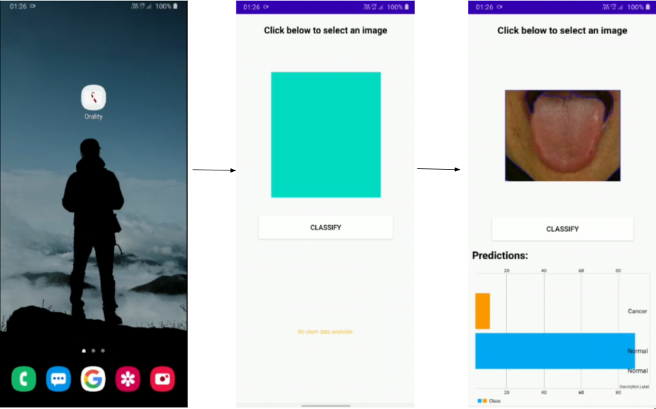 GitHub - Si2-9harth/Oral-Cancer-Detection: For the detection and ...