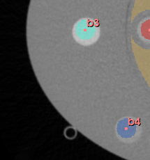 GitHub - tomakela/dectqatool: Dual Energy CT QA Tool