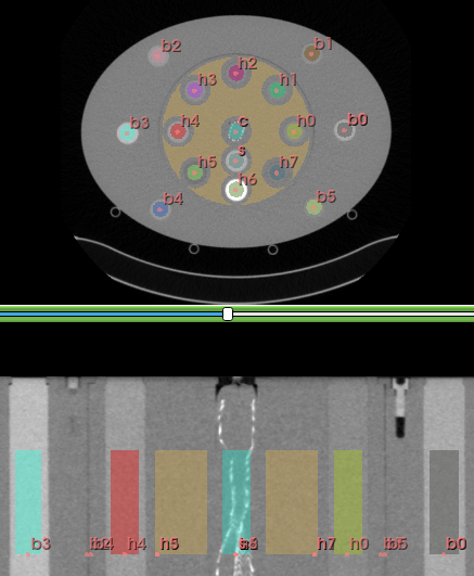 GitHub - tomakela/dectqatool: Dual Energy CT QA Tool