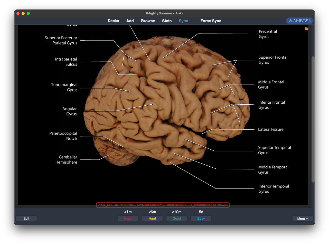 IO one by one issue · Issue #93 · AnKing-VIP/AnKing-Note-Types · GitHub