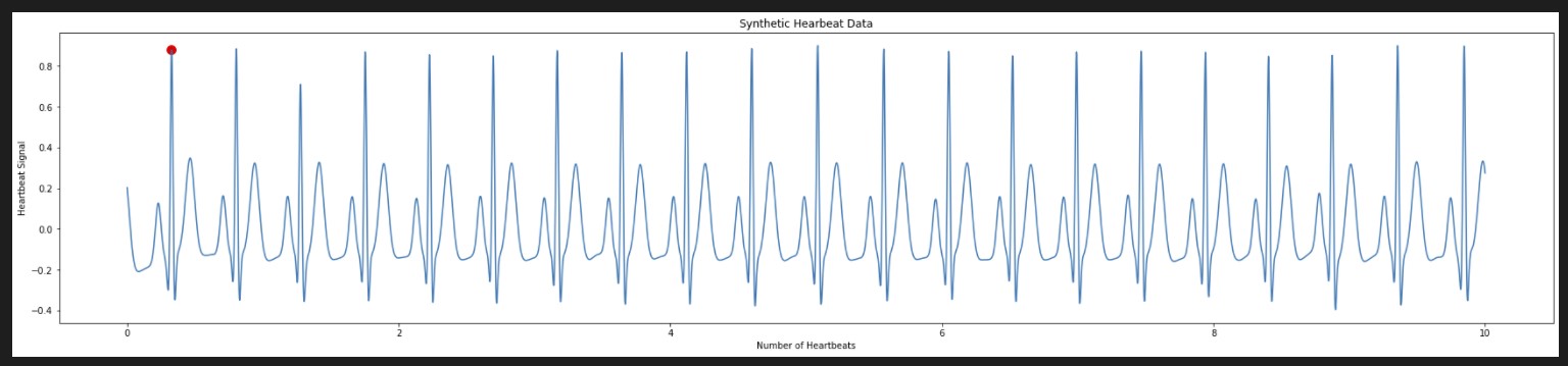 Github Marioph2022 Heartbeat Analysis Anomaly Detection Of Synthetic