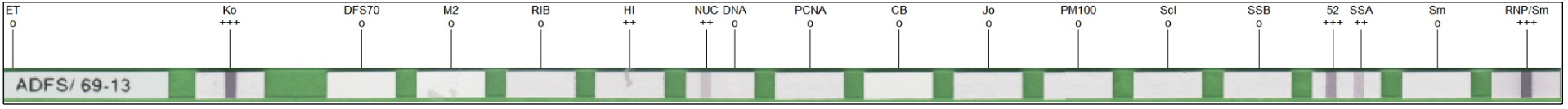 GitHub - atroel01/BlotR: Rapidly extract band-intensities from Line ...