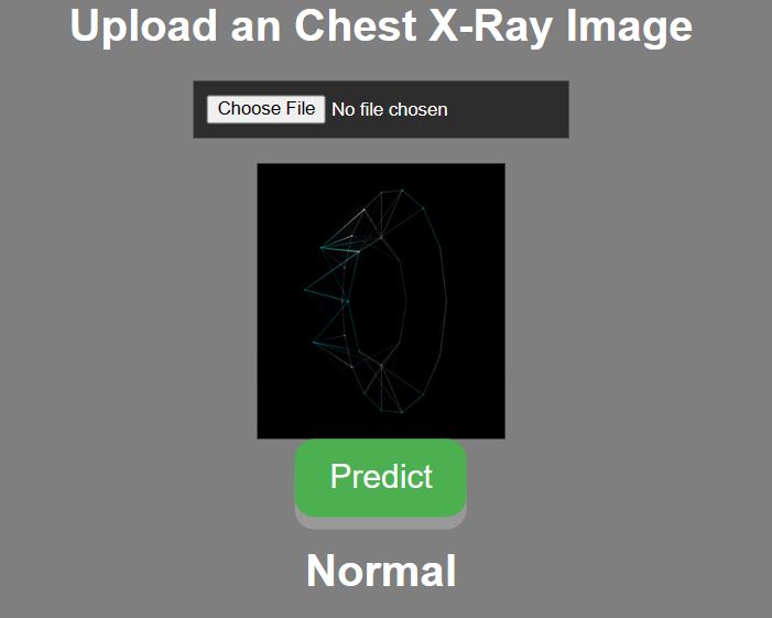 GitHub - AnsariMohsinAhmed/Pneumonia-Detection-Using-Deep-Learning ...