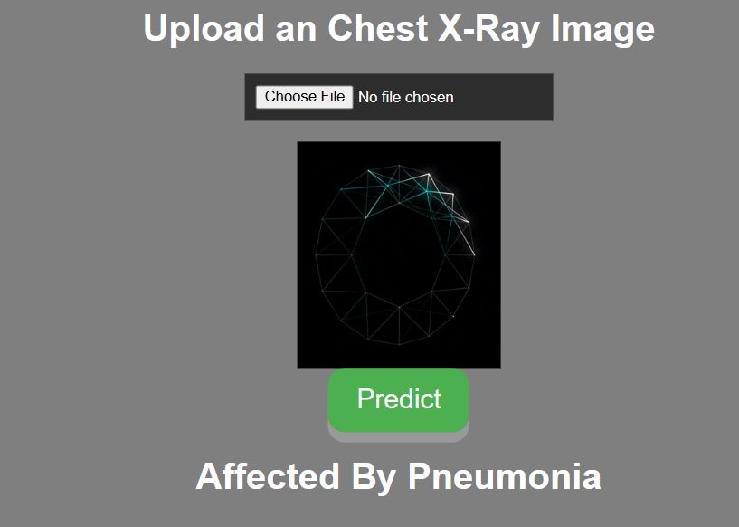 GitHub - AnsariMohsinAhmed/Pneumonia-Detection-Using-Deep-Learning ...