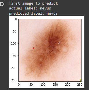 GitHub - DoganK01/SkinCancerDetection