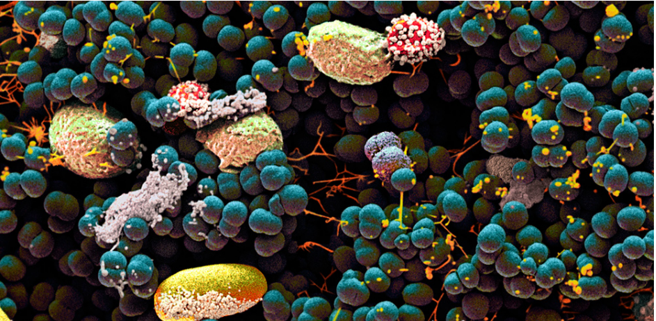 GitHub - jfraz027/BellyButtonDashboard