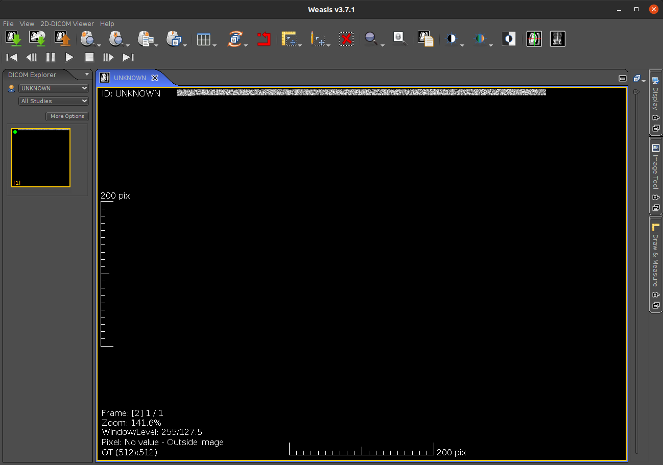 Deflate syntax is not supported for raw image and encapsulated document · Issue #197 · nroduit ...