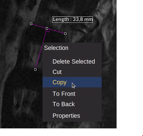 Duplicate the same location ROI at different series · Issue #349 · nroduit/Weasis · GitHub