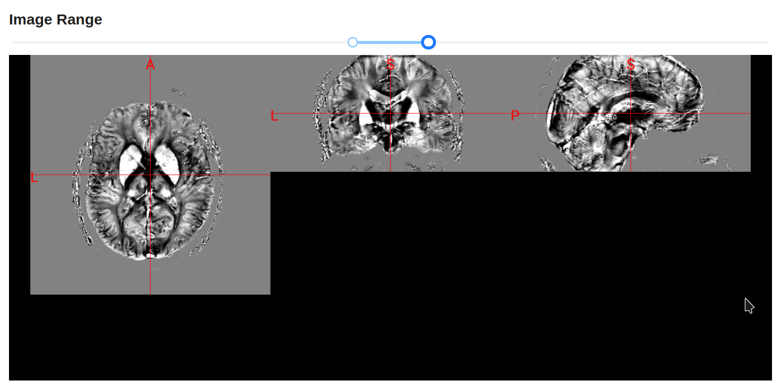 Update contrast/windowing interactively · Issue #645 · niivue/niivue · GitHub