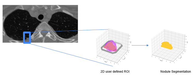 GitHub - amalmsaleem/Lung-Nodule-Quantification