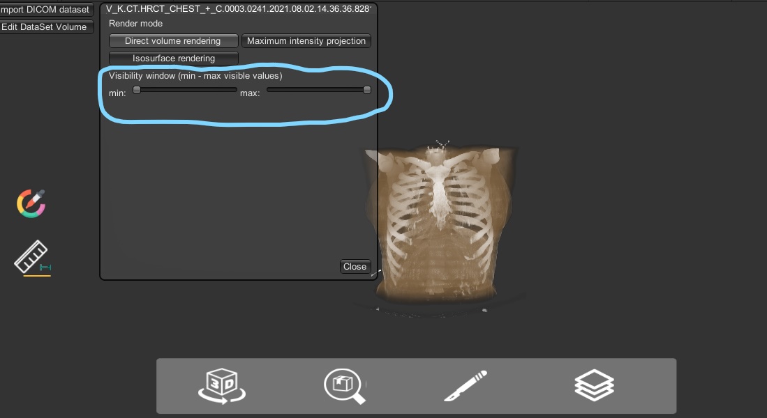 Changing Intensity by pressing scroll button · Issue #153 · mlavik1/UnityVolumeRendering · GitHub